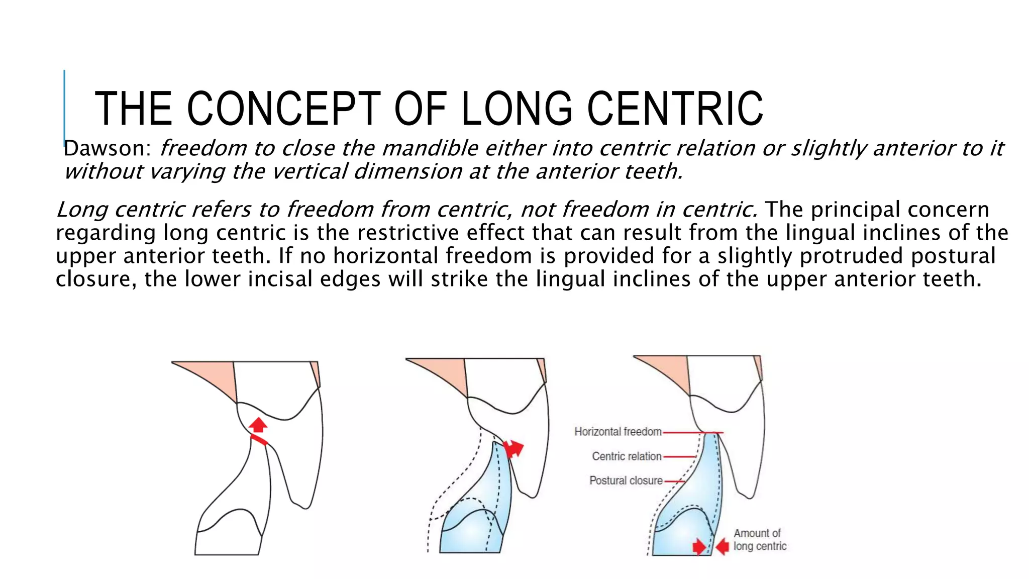 Centric Relation .pptx