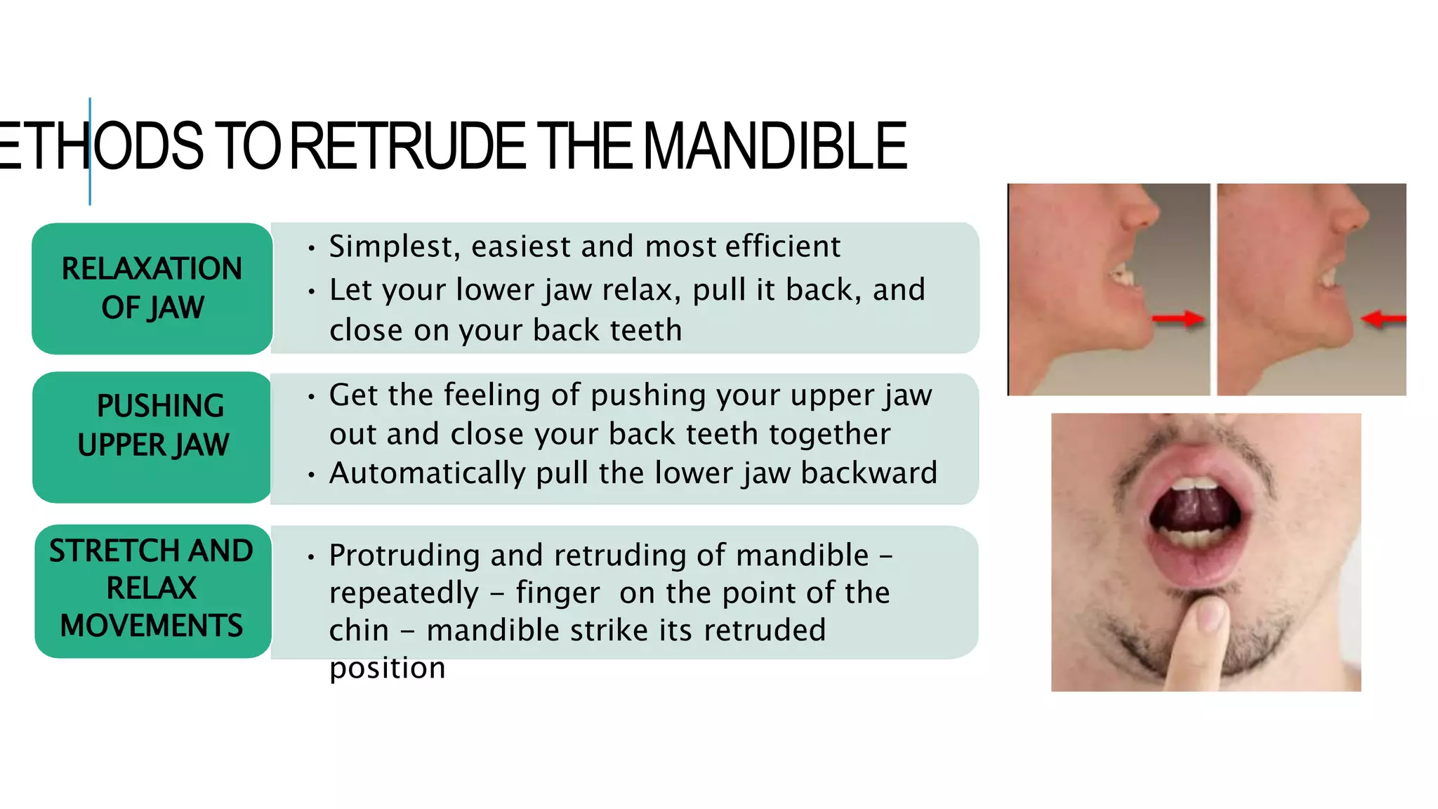 Centric Relation .pptx