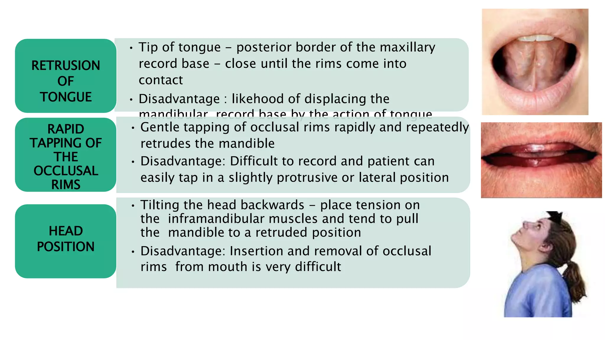 Centric Relation .pptx