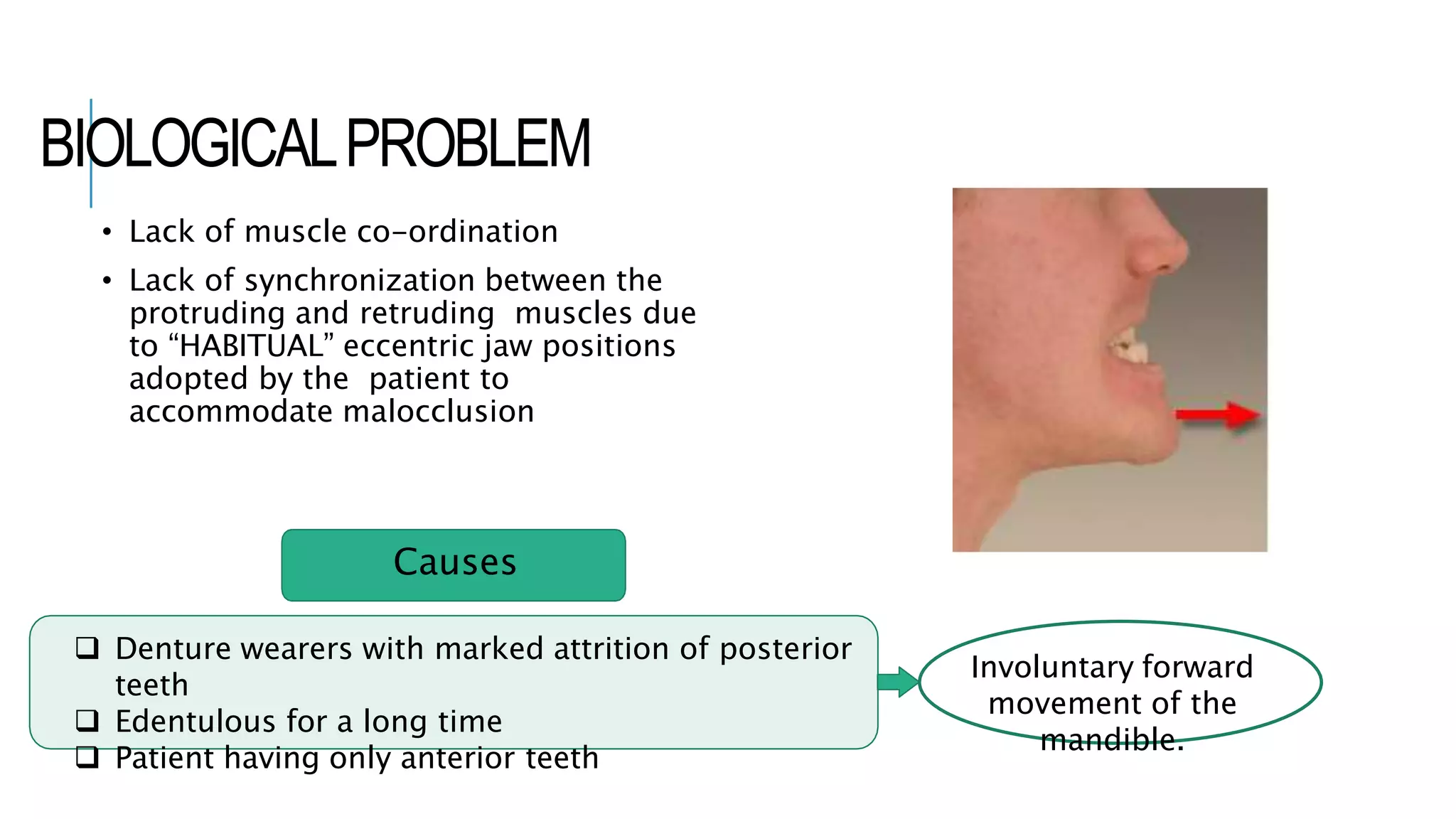 Centric Relation .pptx