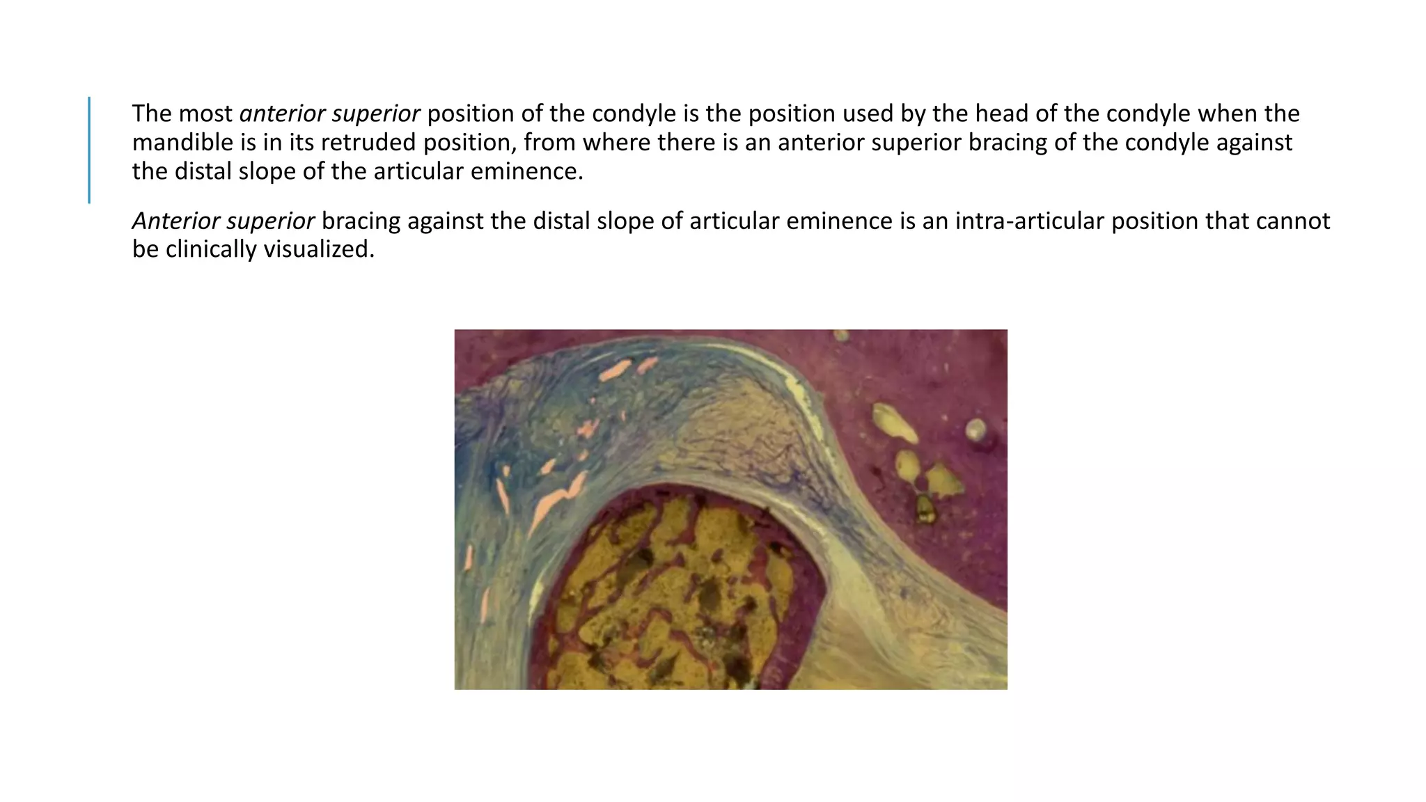 Centric Relation .pptx