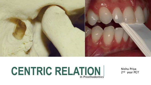 Centric Relation .pptx