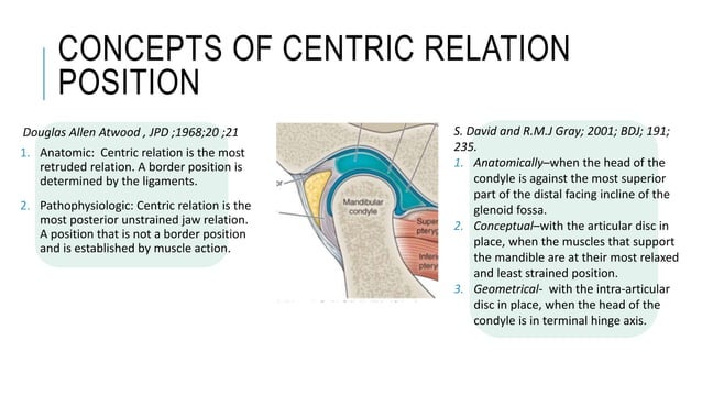 Centric Relation .pptx