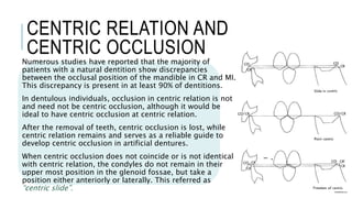 Centric Relation .pptx