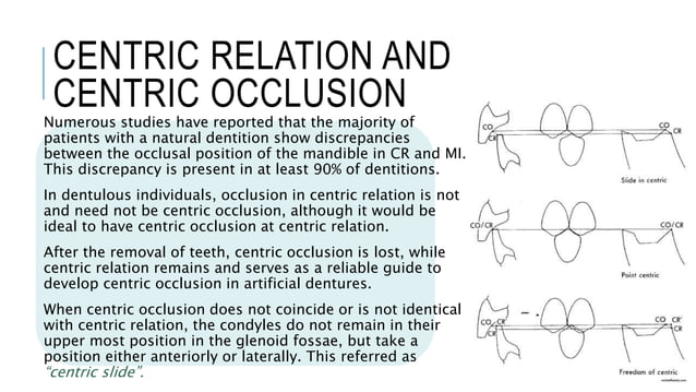 Centric Relation .pptx