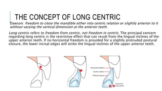 Centric Relation .pptx