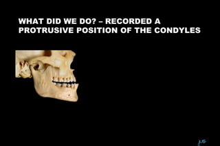 Centric relation.ppt