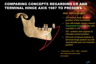 Centric relation.ppt
