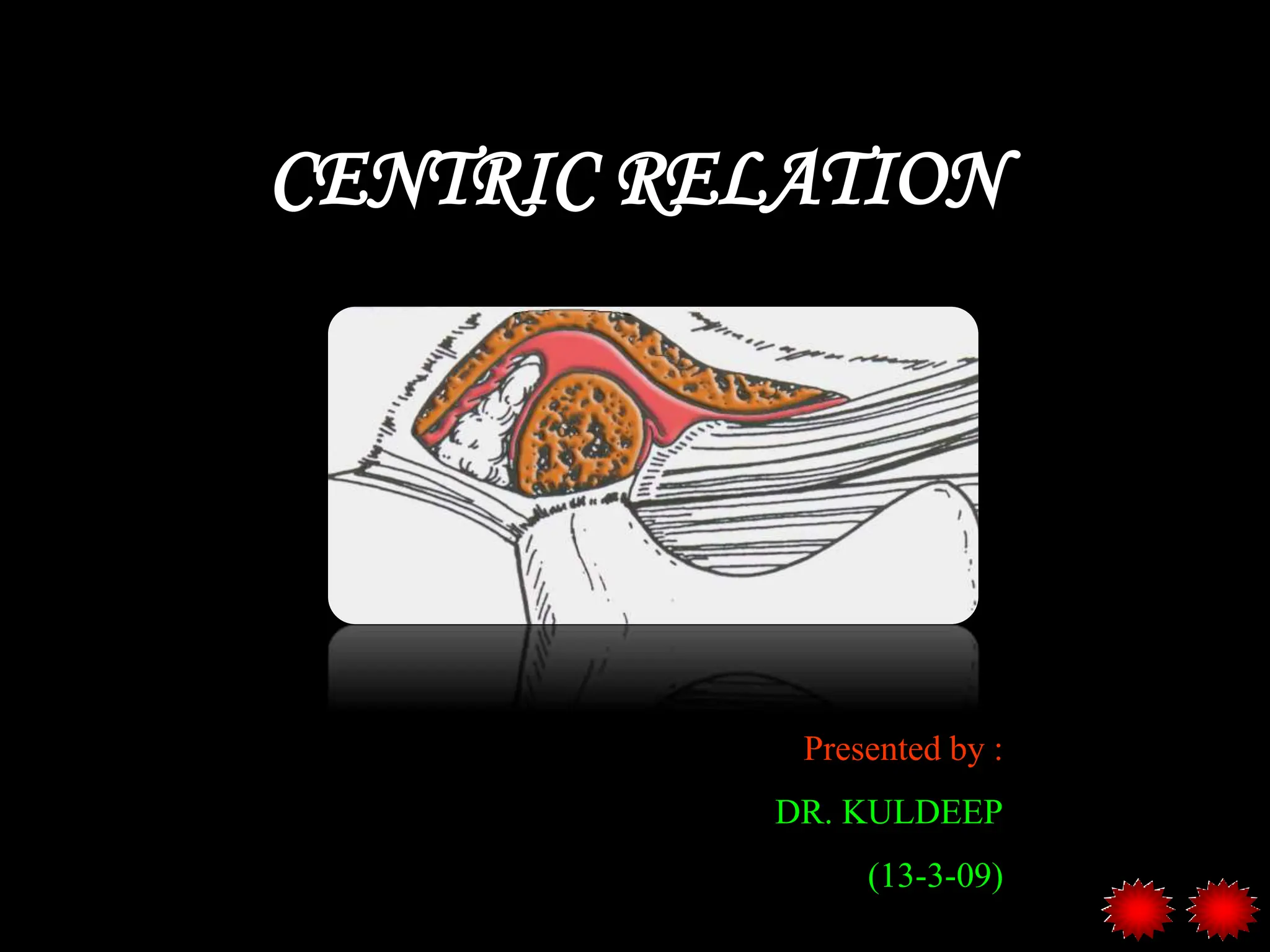 centric relation in complete denture prosthodontics | PPT
