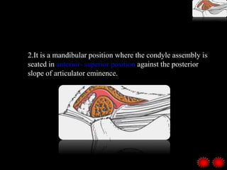 centric relation in complete denture prosthodontics | PPT
