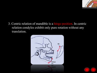 centric relation in complete denture prosthodontics | PPT