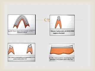 Centric relation anto | PPTX