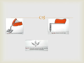 Centric relation anto | PPTX