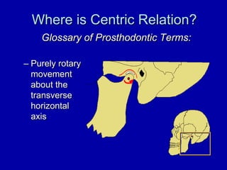 Centric Relation CD.ppt
