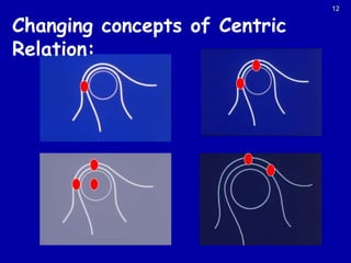 Centric Relation CD.ppt | Oral care | Personal Care