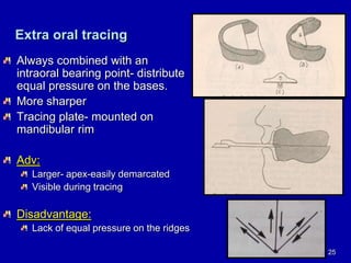 Centric Relation CD.ppt