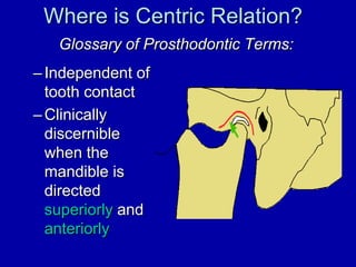 Centric Relation CD.ppt