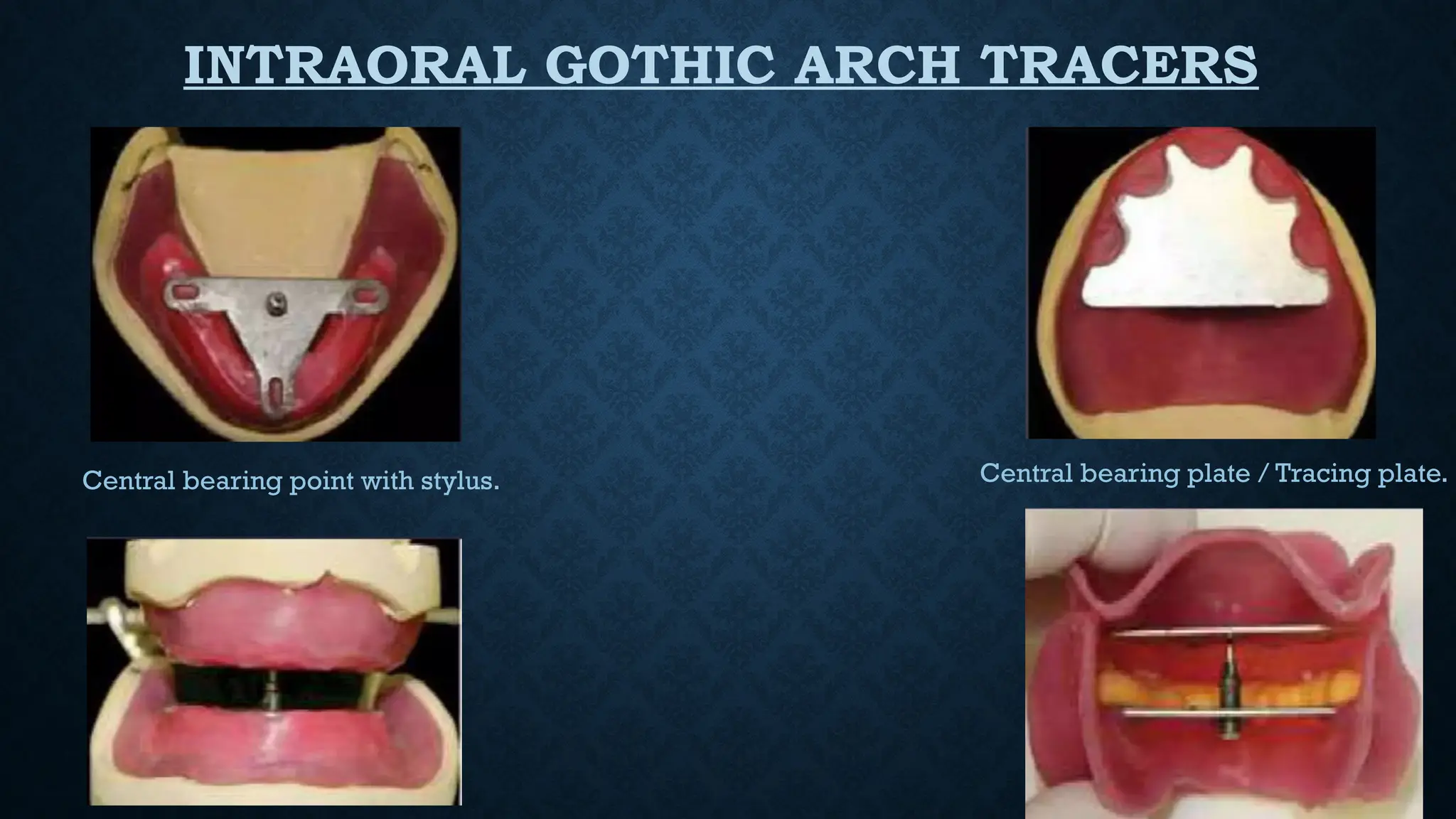 Centric relation & its importancess.pptx