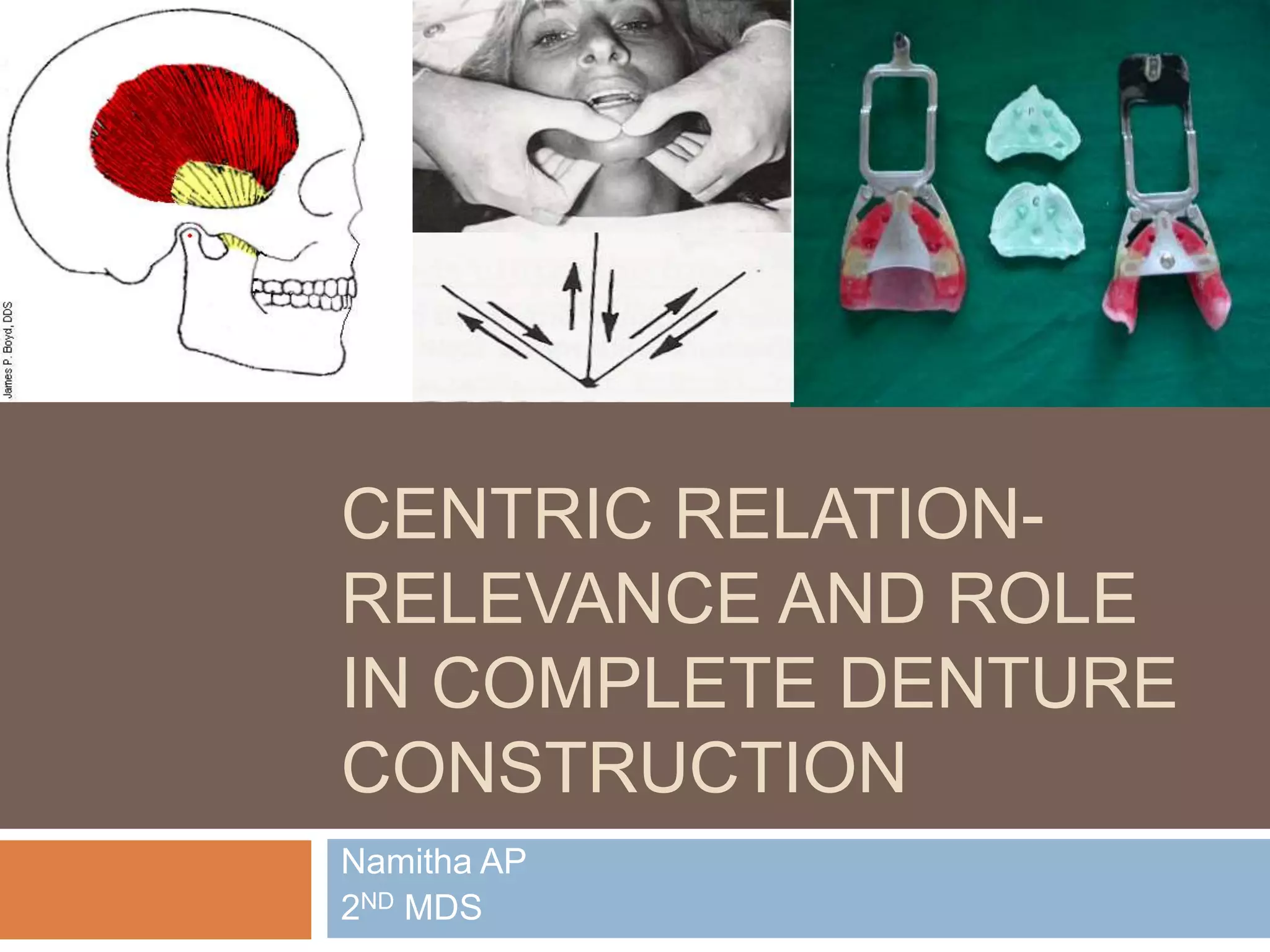 Centric relation relevance and role in complete denture construction | PPTX