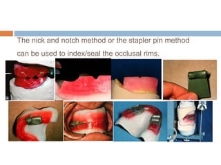 Centric relation relevance and role in complete denture construction | PPTX