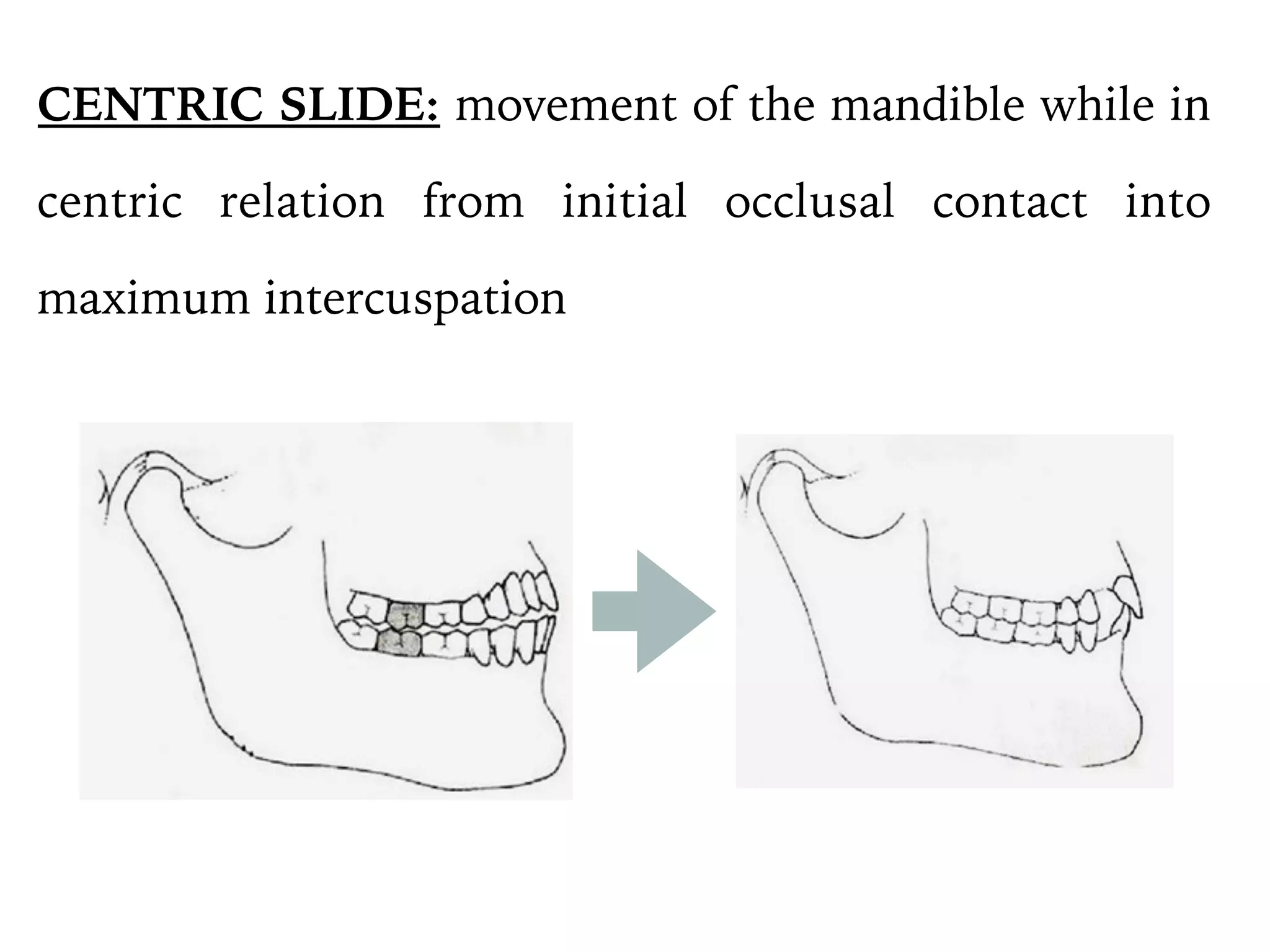 Centric relation seminar | PDF