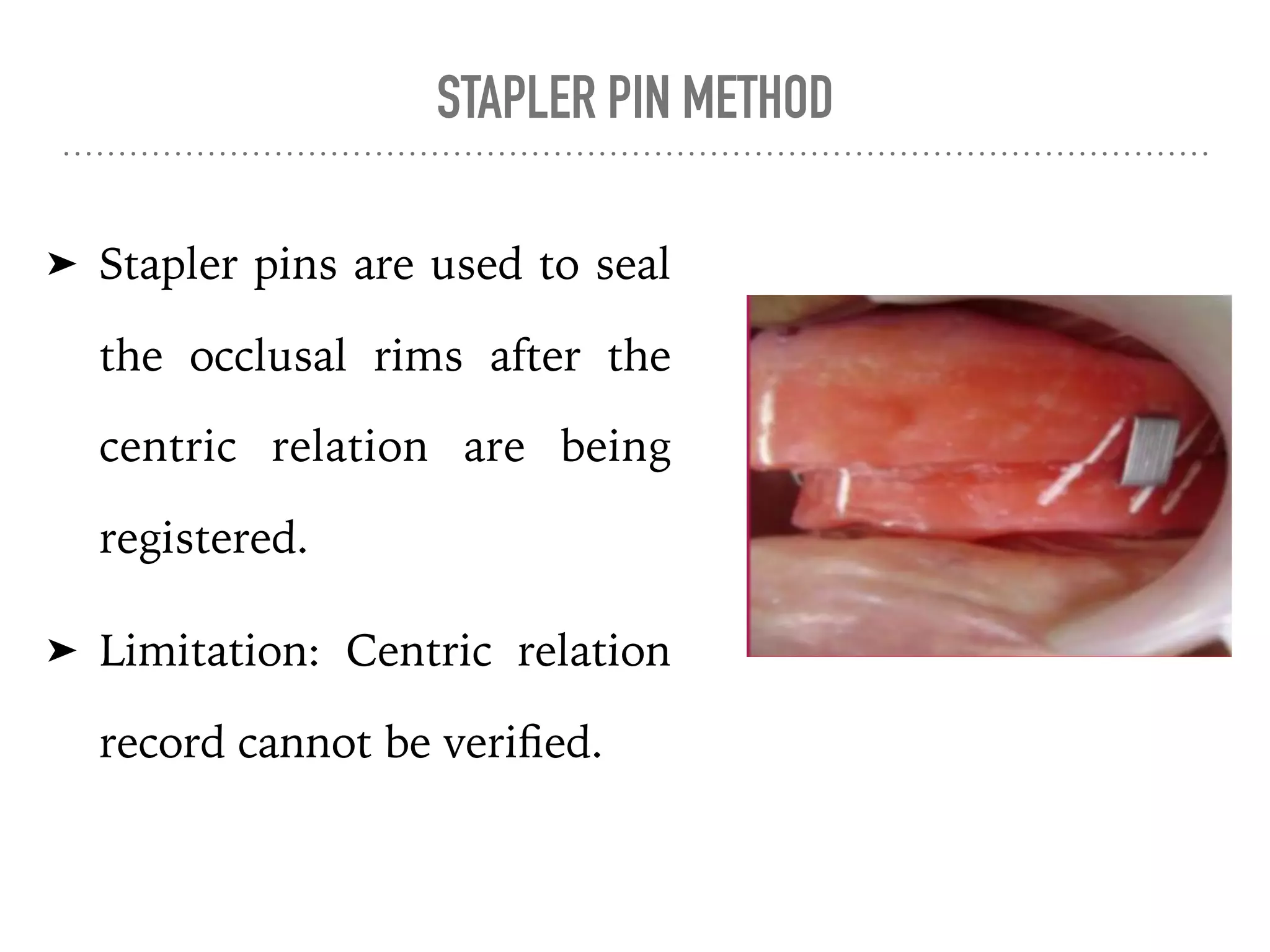 Centric relation seminar | PDF