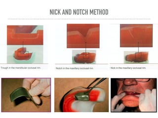 Centric relation seminar | PPT