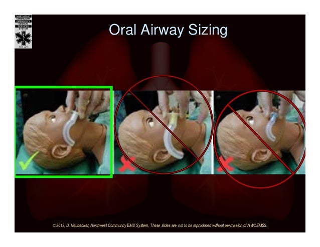 CE oct 12 airway key