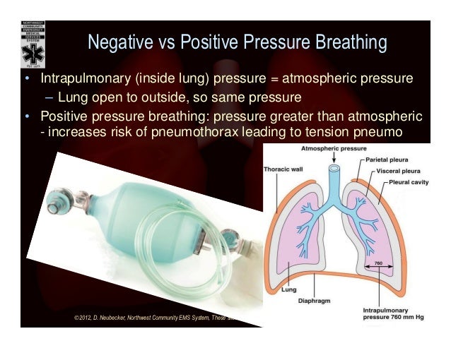 CE oct 12 airway key
