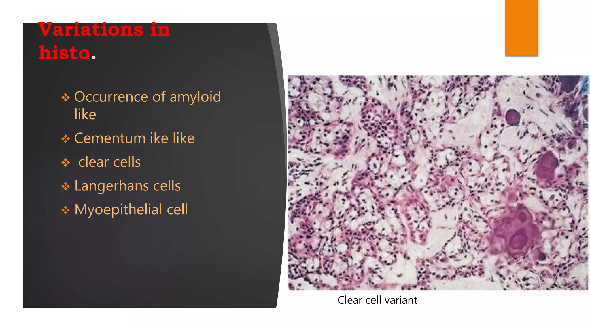 calcifying epithelial odontogenic tumor Ceot | PPTX