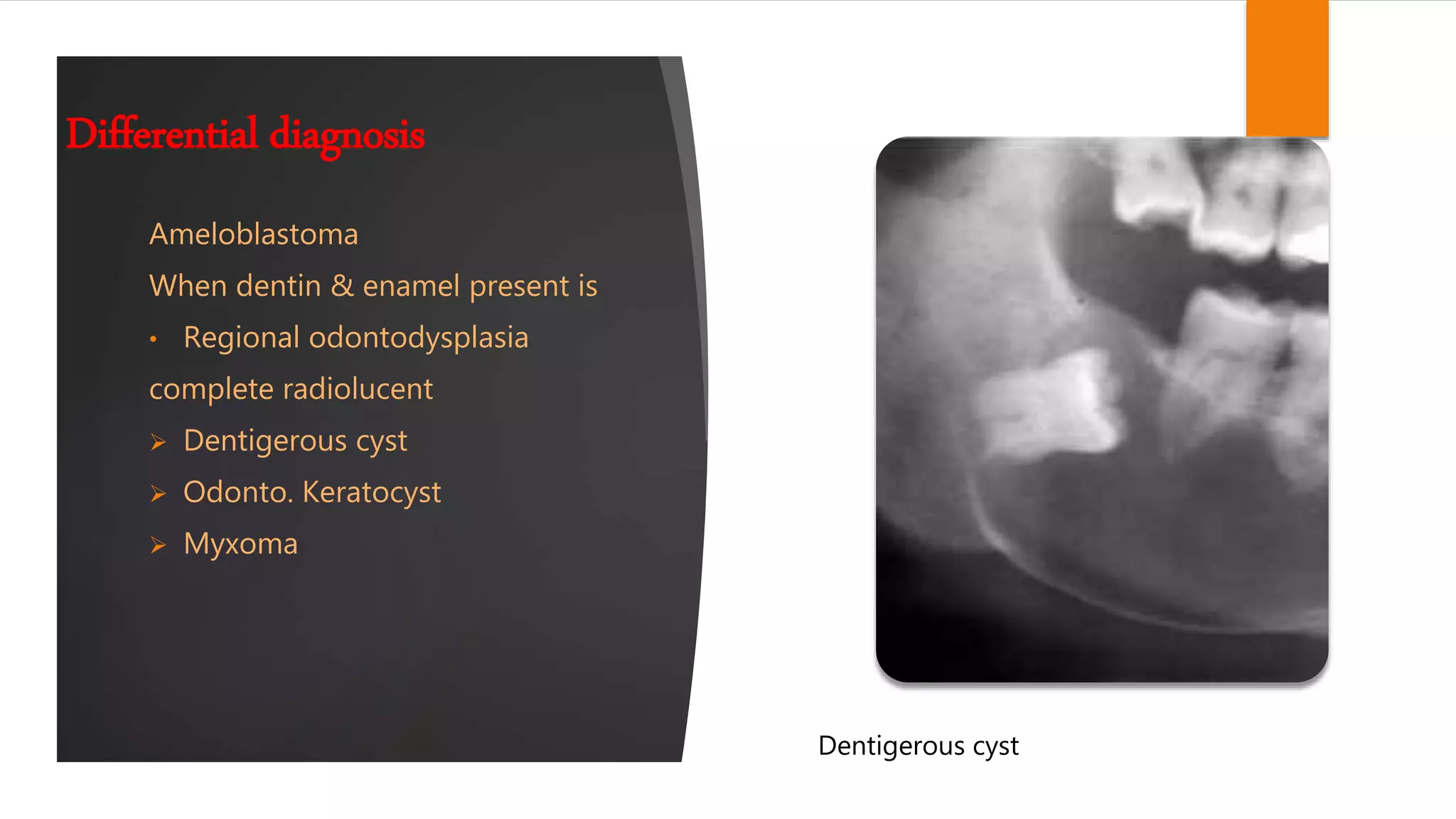 calcifying epithelial odontogenic tumor Ceot | PPTX