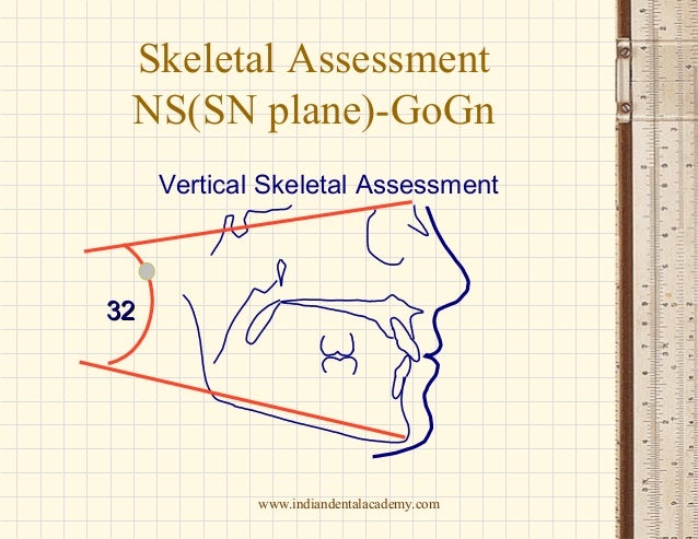Ceph /certified fixed orthodontic courses by Indian dental academy
