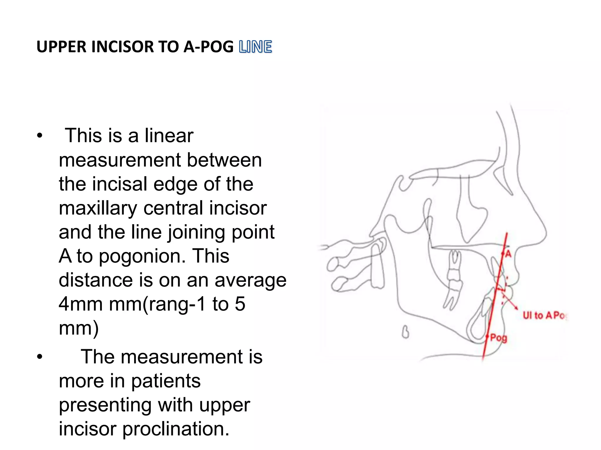 Cephalometric Analysis | PPTX