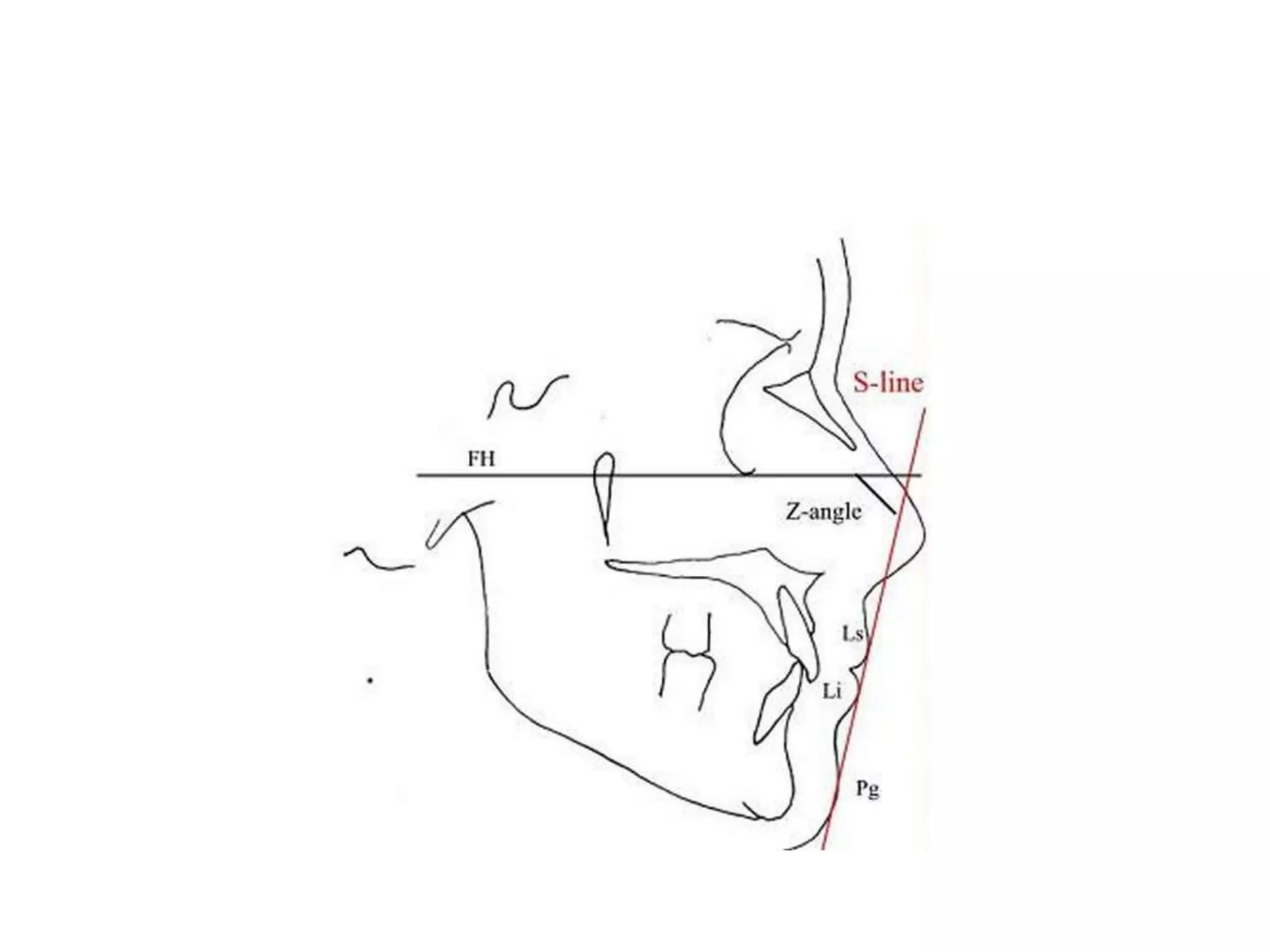 Cephalometric Analysis | PPTX