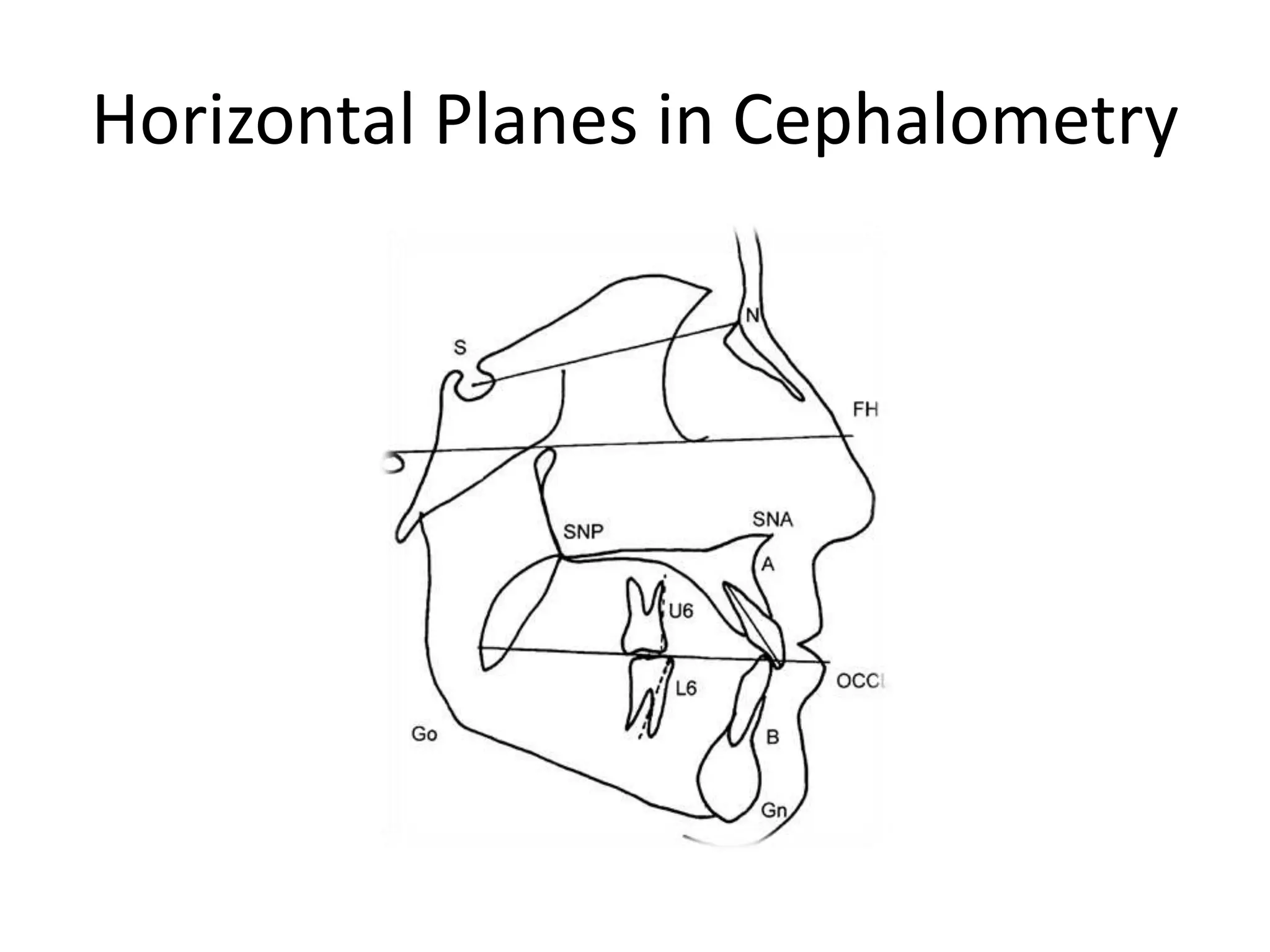 Cephalometric Analysis | PPTX