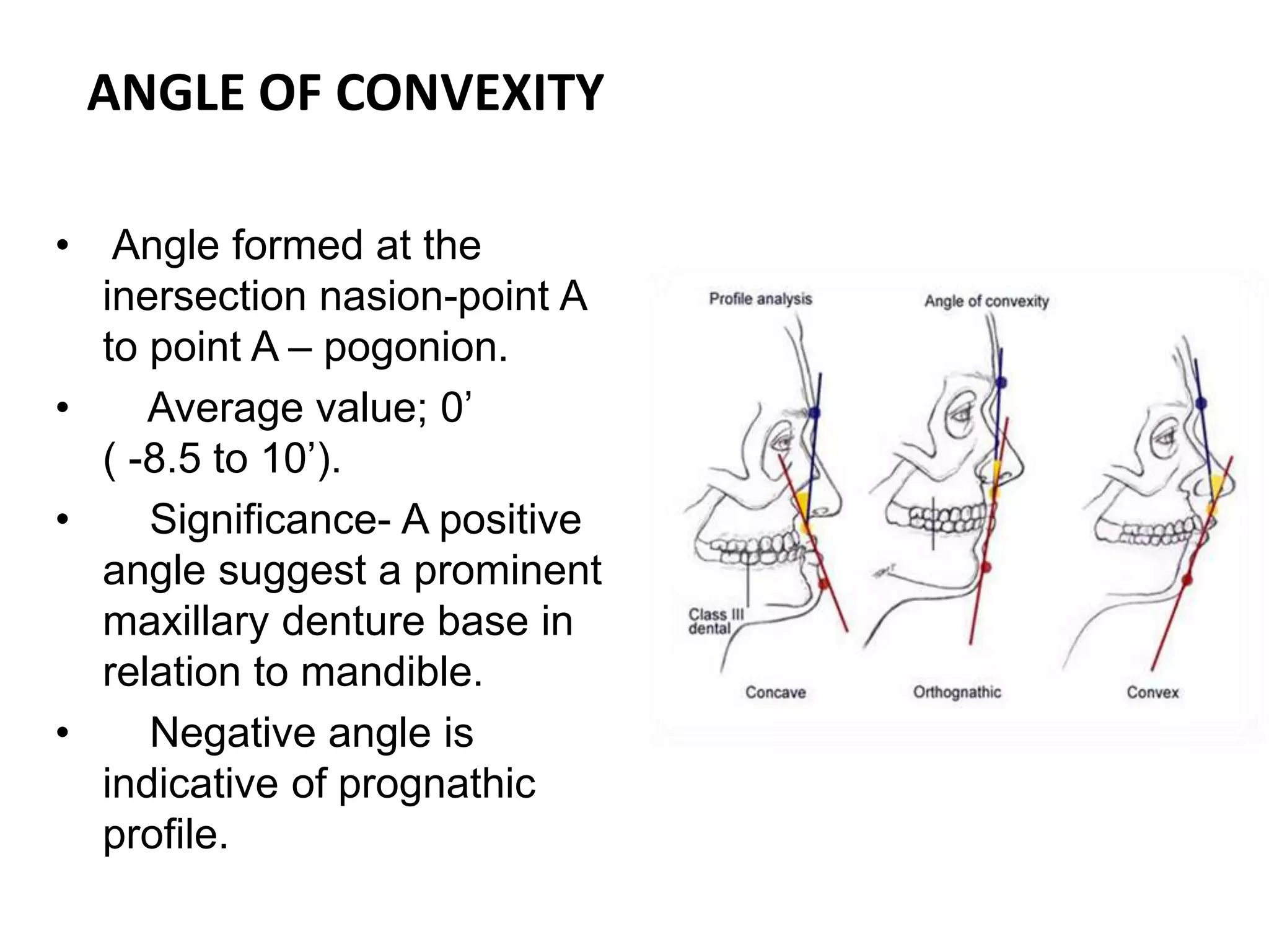 Cephalometric Analysis | PPTX