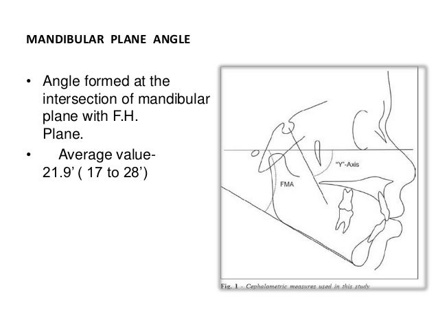 Cephalometric Analysis