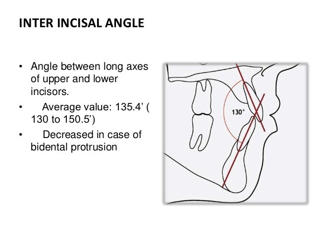 Cephalometric Analysis