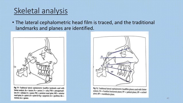 Lateral cephalometric analysis of hard tissues | PPTX | Dental Health | Diseases and Conditions