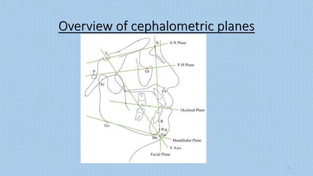 Lateral cephalometric analysis of hard tissues | PPTX | Dental Health ...