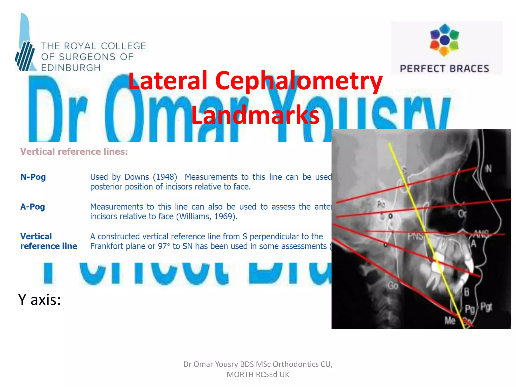 lateral Cephalometry | PPTX
