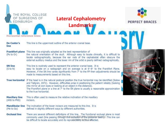 lateral Cephalometry | PPTX