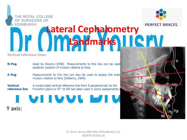 lateral Cephalometry | PPTX
