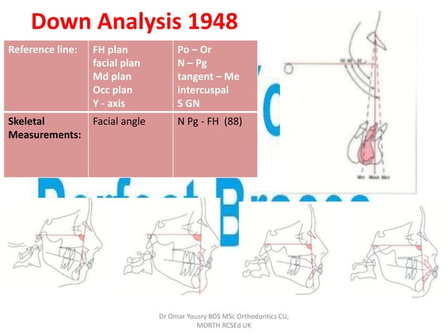 lateral Cephalometry | PPTX