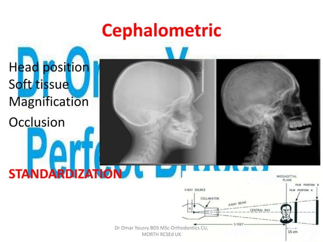 lateral Cephalometry | PPTX