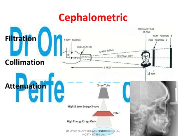 lateral Cephalometry | PPTX