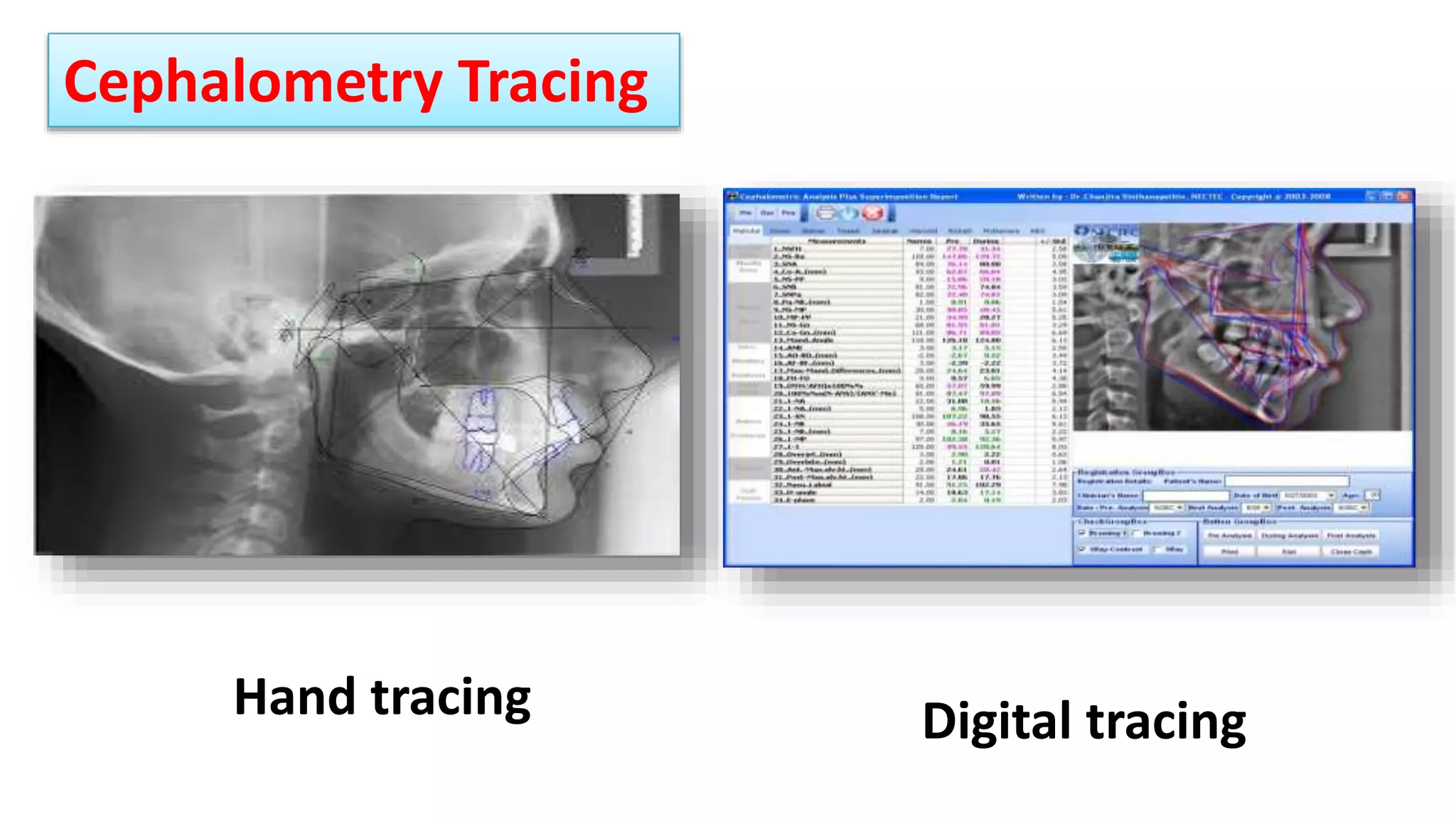 Cephalometrics | PPTX