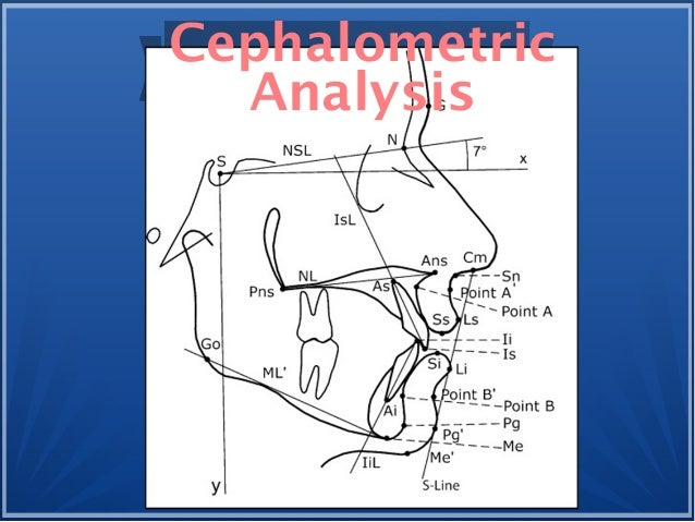 Cephalometric history, evolotion & landmarks1