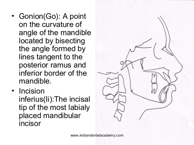 Cephalometrics introdction basics