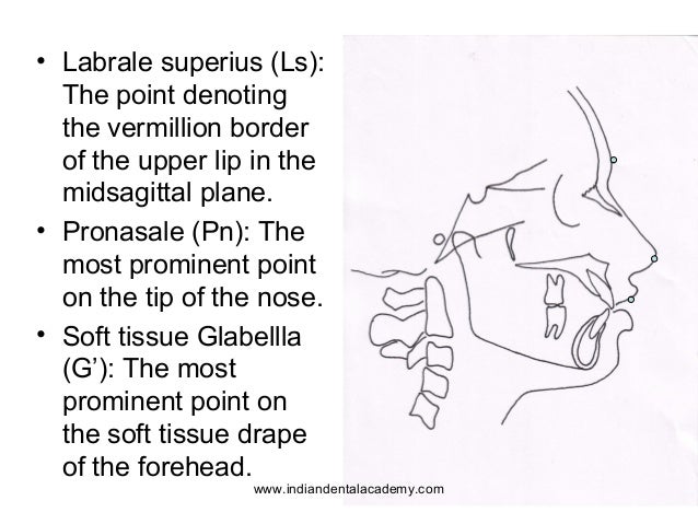 Cephalometrics introdction basics